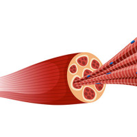 Matériel de kiné - maux de dos, trouble de l'équilibre